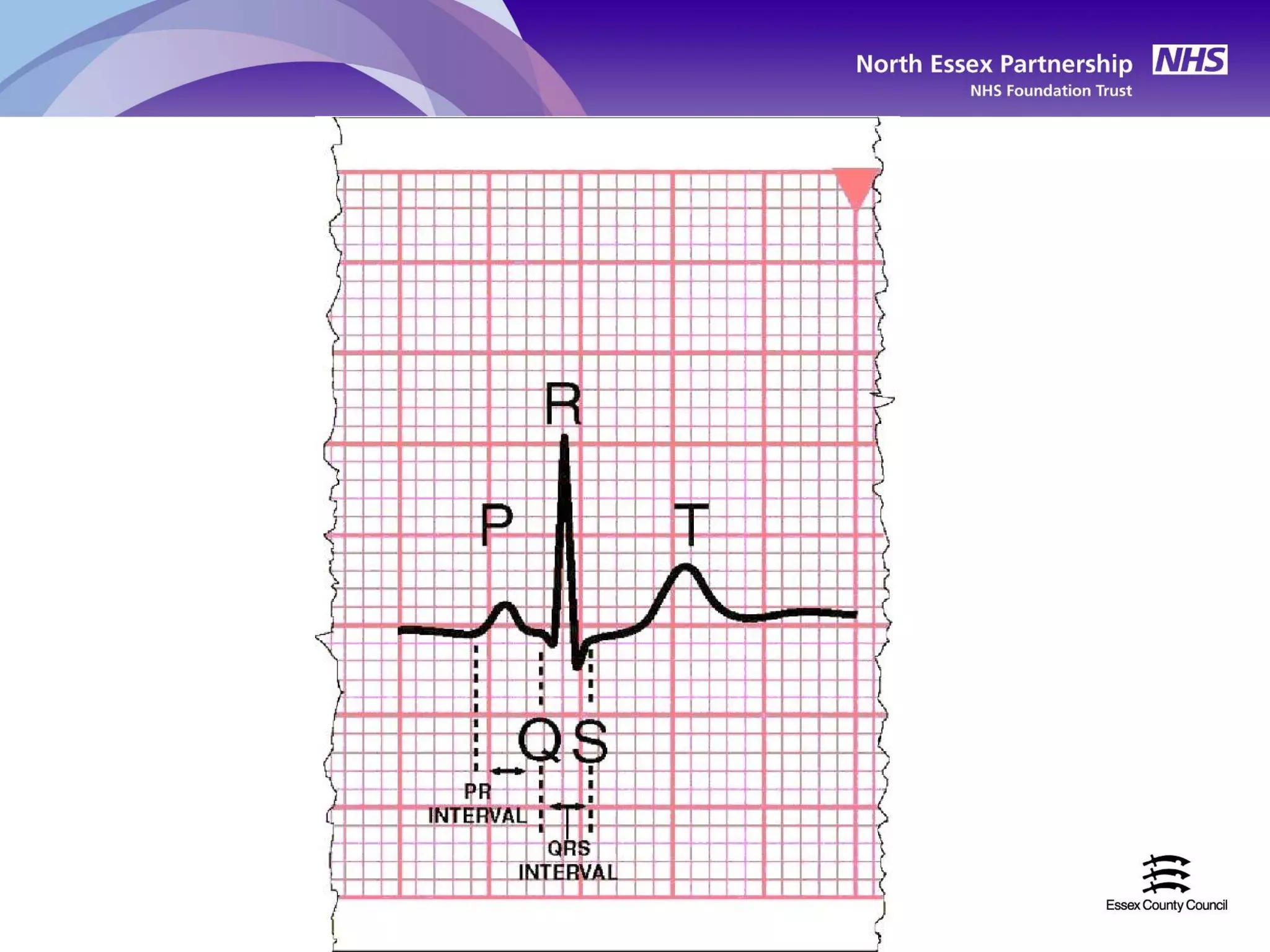 Ecg recording basic interpretation e learning 2 | PPT | Heart and ...