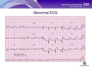 Ecg recording basic interpretation e learning 2 | PPT | Heart and ...