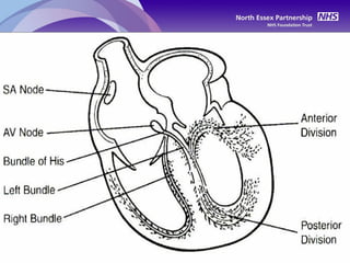 Ecg recording basic interpretation e learning 2 | PPT | Heart and Cardiovascular Diseases ...
