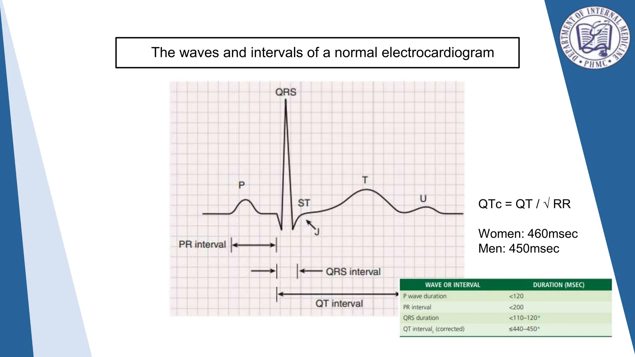 Ecg report normal sinus rhythm with variants of qrs complex.pptx