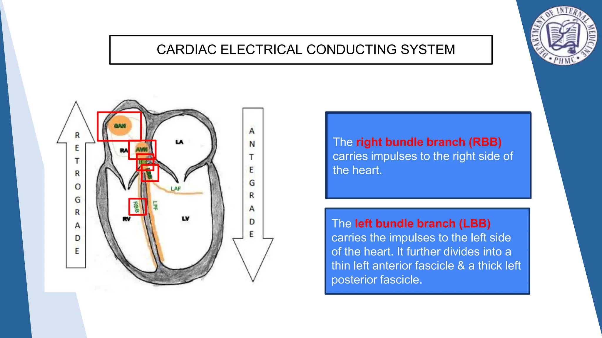 Ecg report normal sinus rhythm with variants of qrs complex.pptx