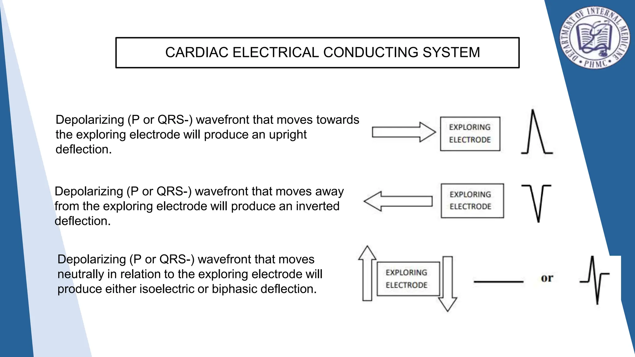 Ecg report normal sinus rhythm with variants of qrs complex.pptx