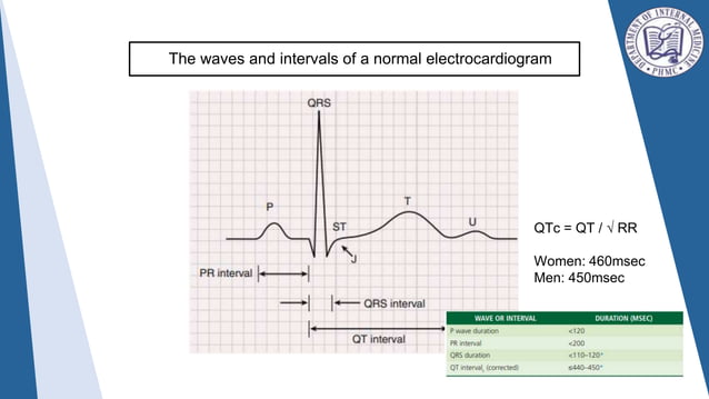 Ecg report normal sinus rhythm with variants of qrs complex.pptx