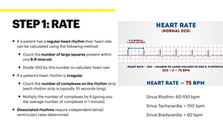 ECG REview.pdf