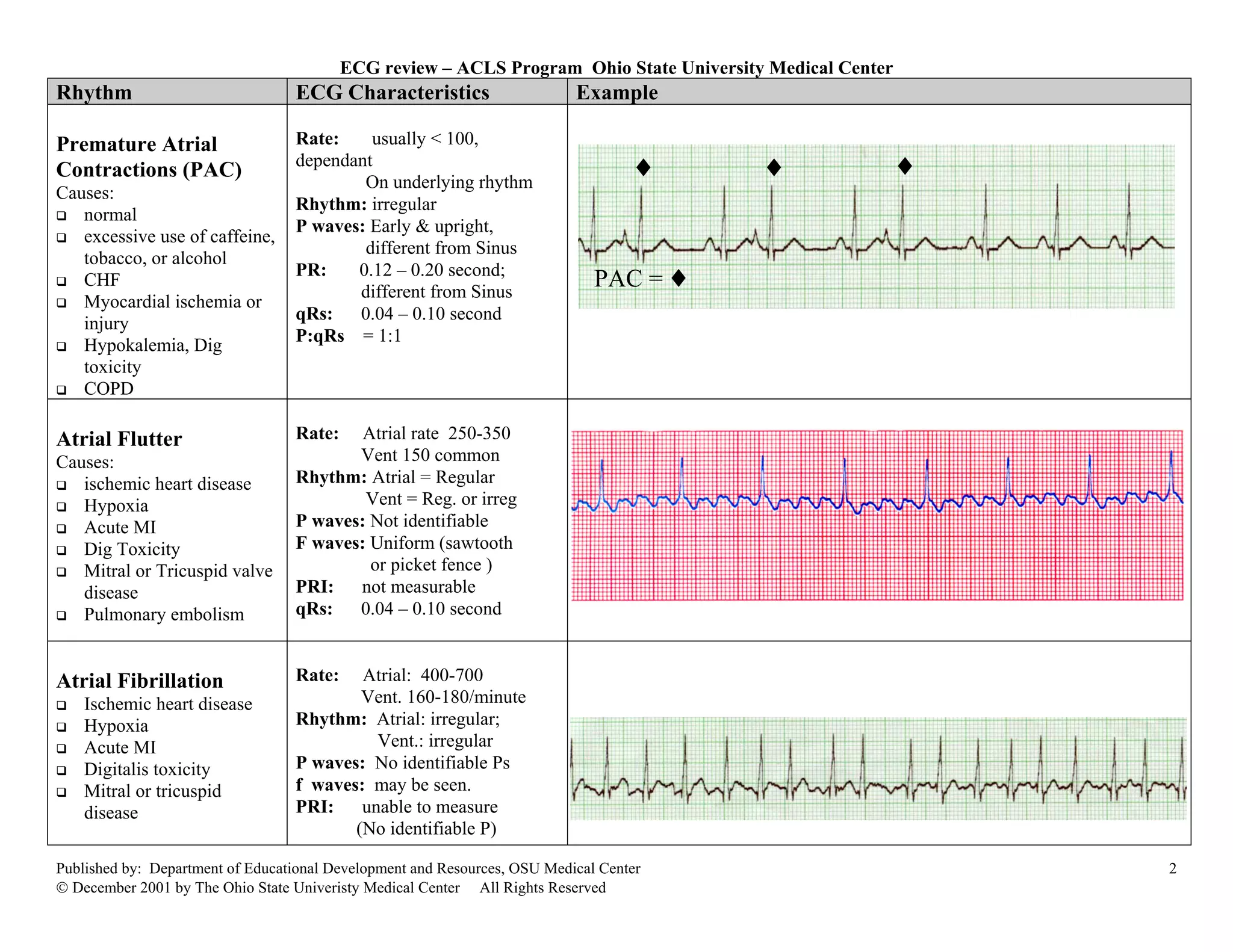 Ecg rhythms charex | PDF