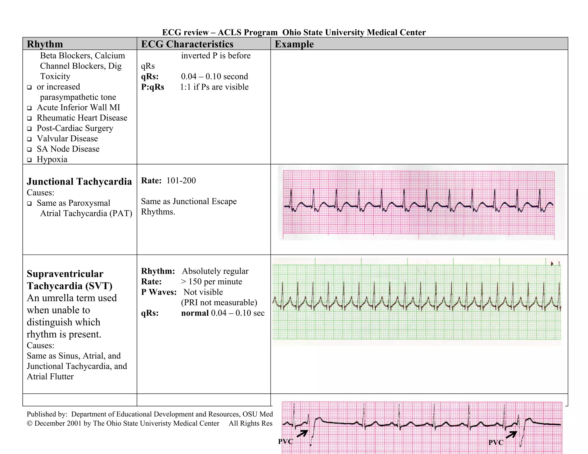 Ecg rhythms charex | PDF