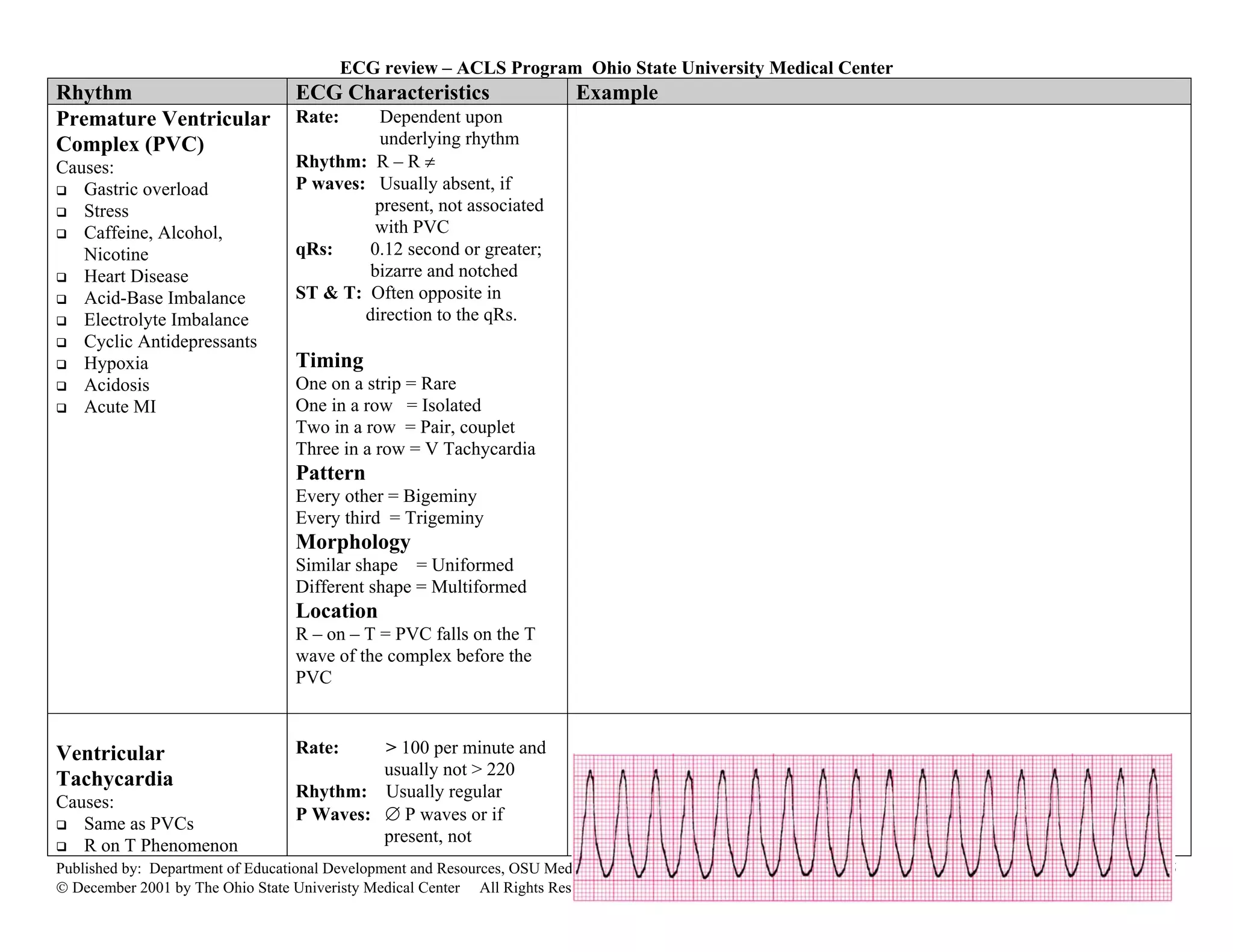 Ecg rhythms charex | PDF