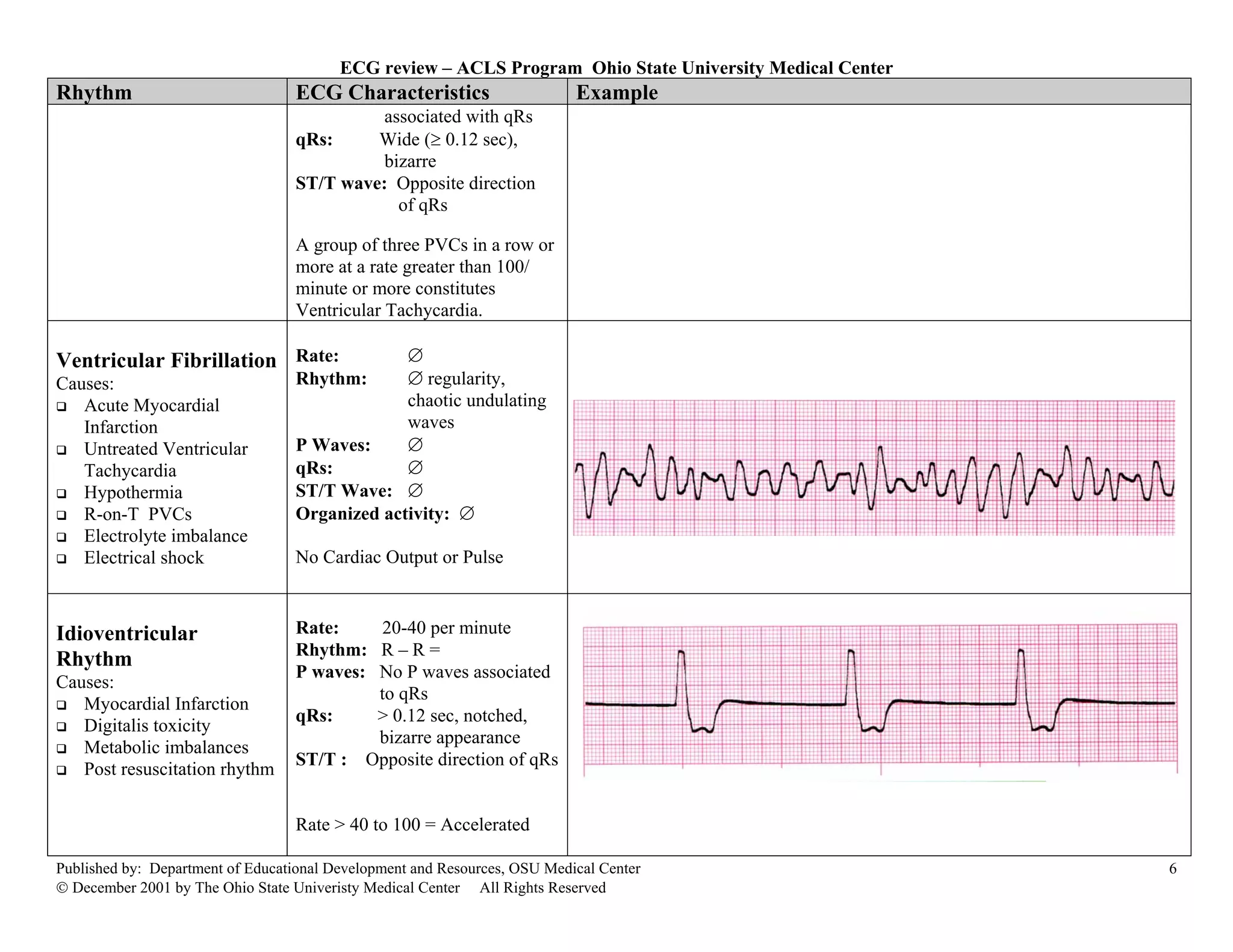 Ecg rhythms charex | PDF