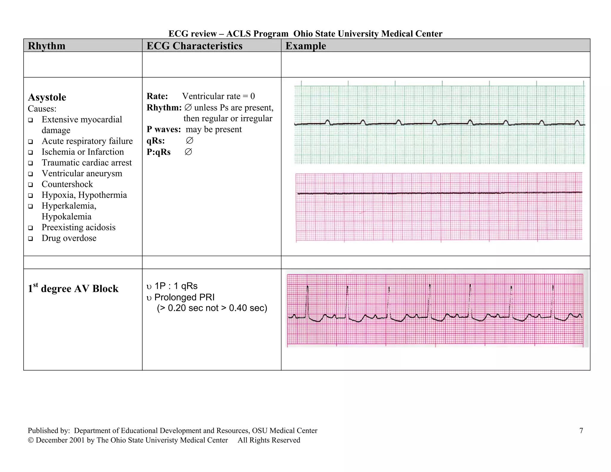 Ecg rhythms charex | PDF