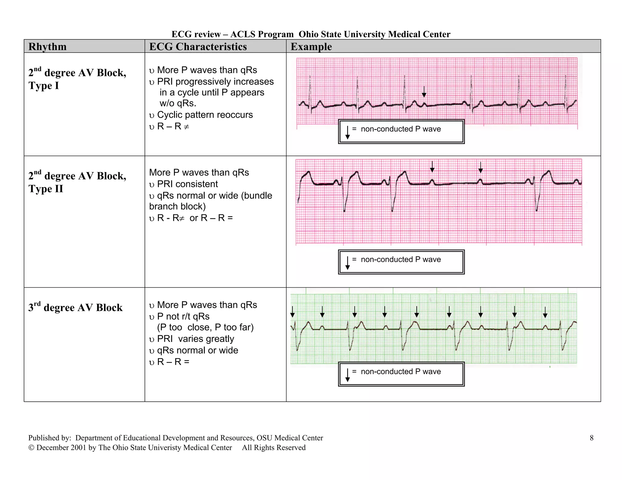Ecg rhythms charex | PDF