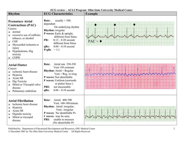 Ecg rhythms charex | PDF | Heart and Cardiovascular Diseases | Diseases ...