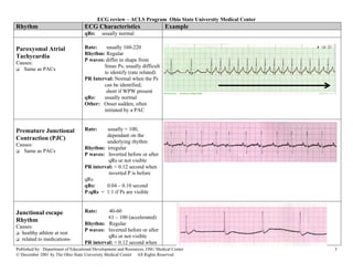 Ecg rhythms charex | PDF