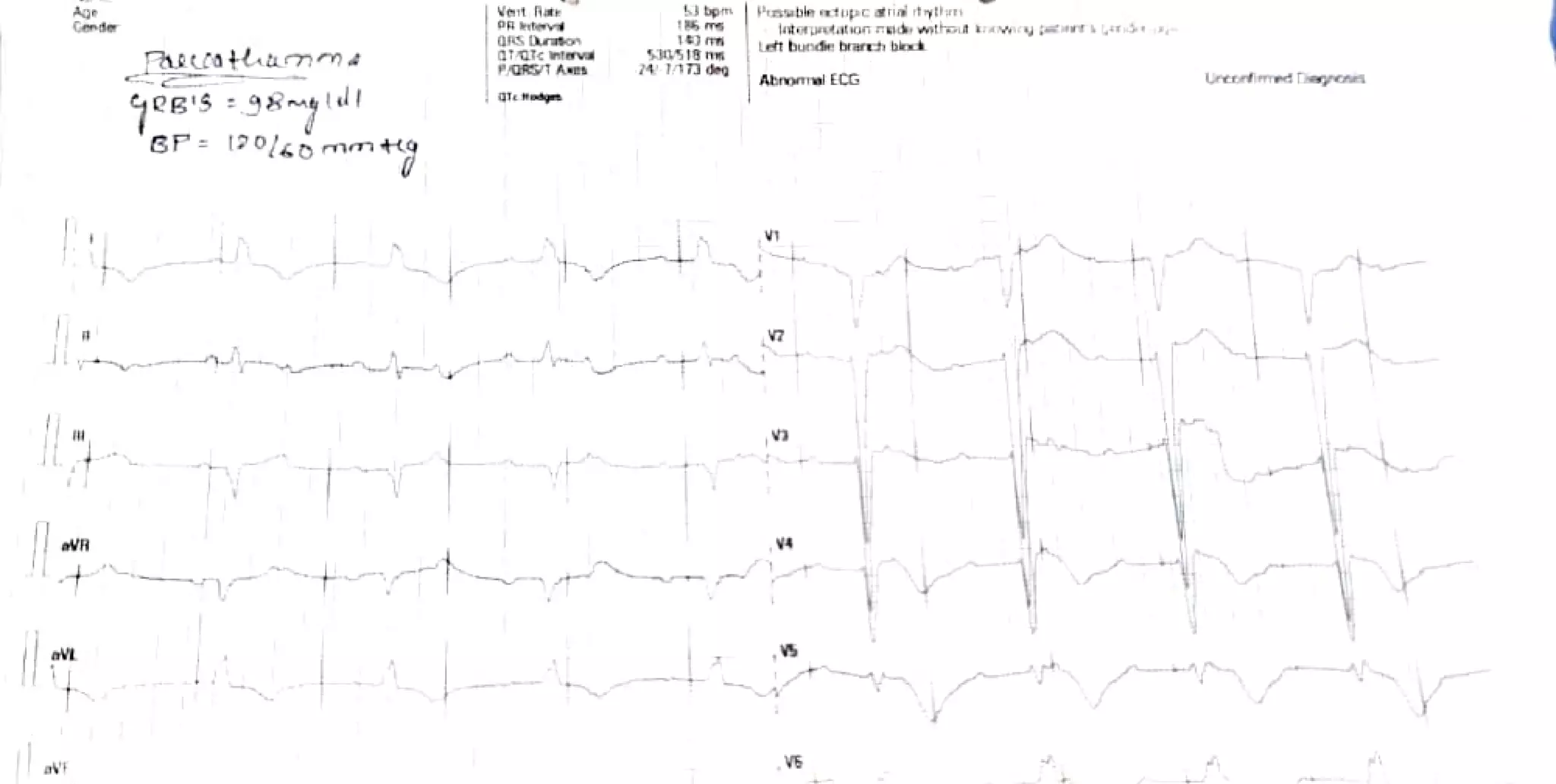 ECGS.pdf