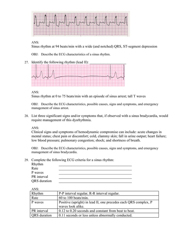 Ecgs Made Easy 5th Edition Aehlert Test Bank | PDF | Heart and ...