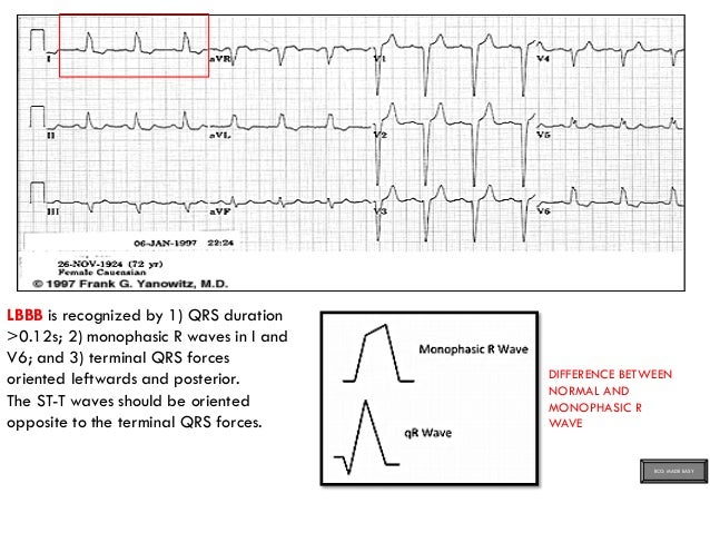 Ecg samples