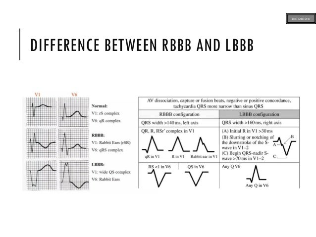 Ecg samples