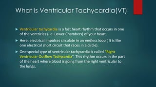 Heart Arrhythmia | PPTX