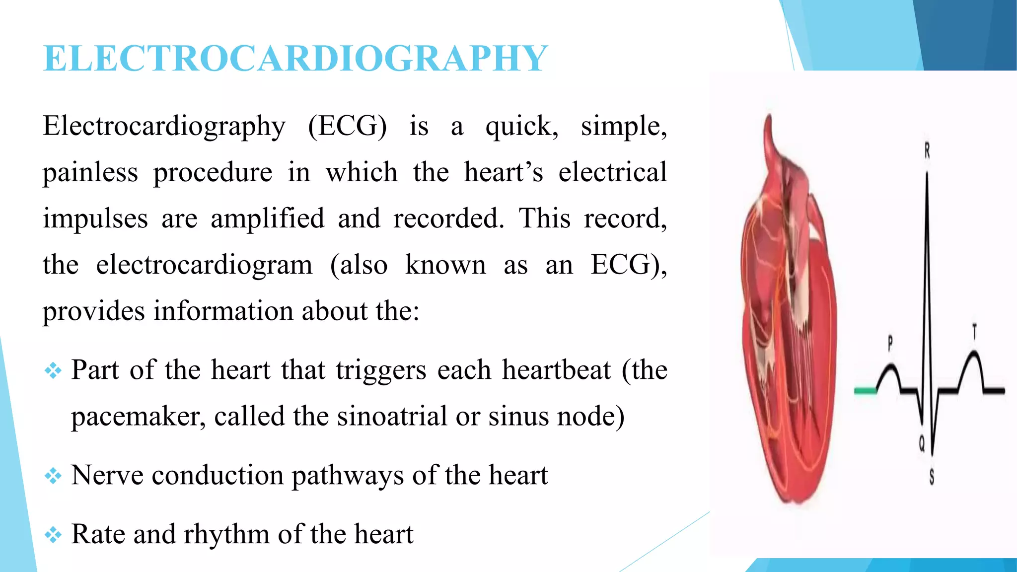 EDUCATIONAL PROGRAMME ON ECG pptx | PPT