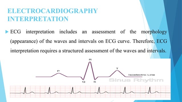 EDUCATIONAL PROGRAMME ON ECG pptx | PPT