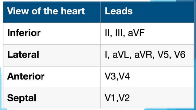 EDUCATIONAL PROGRAMME ON ECG pptx | PPT