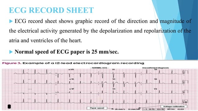 EDUCATIONAL PROGRAMME ON ECG pptx | PPT
