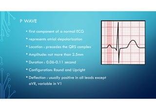 ECG Series on Other Parts of ECG as part of requirement | PDF