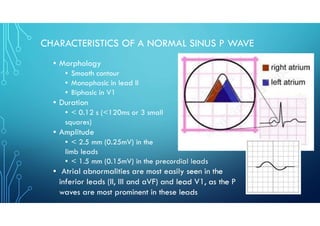 ECG Series on Other Parts of ECG as part of requirement | PDF
