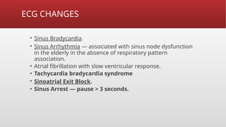 ECG sick sinus syndrome in emergency dept .pptx