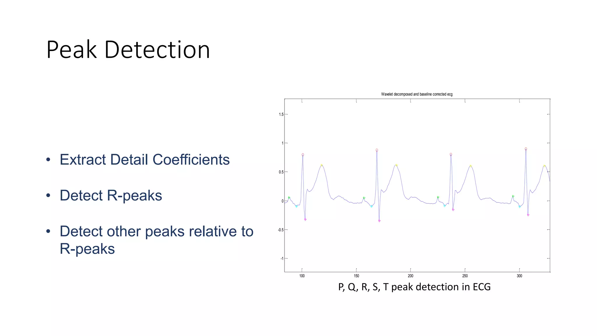 Ecg Signal Analysis For Myocardial Infarction Detection Ppt