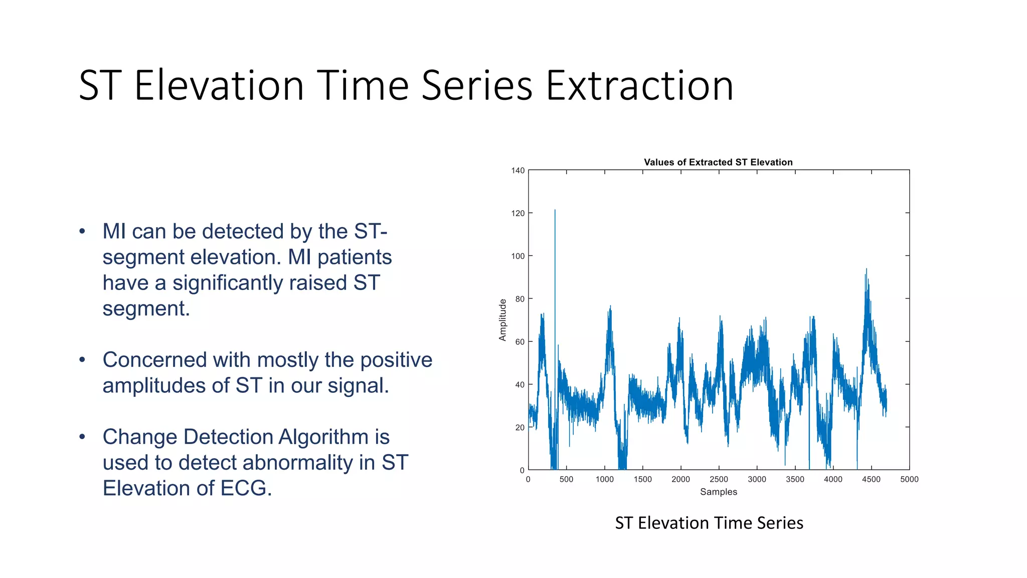 Ecg Signal Analysis For Myocardial Infarction Detection Ppt