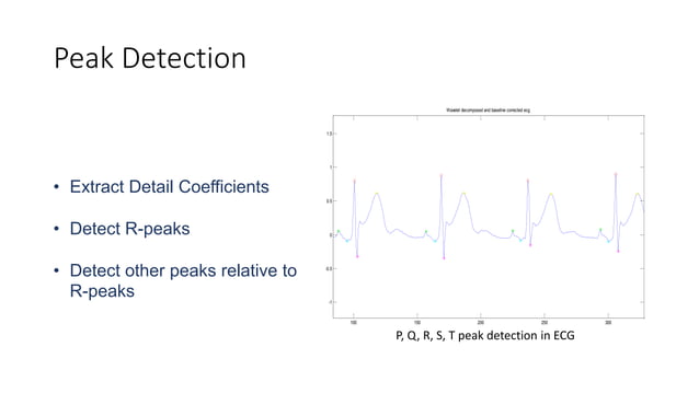 ECG Signal Analysis for Myocardial Infarction Detection | PPT