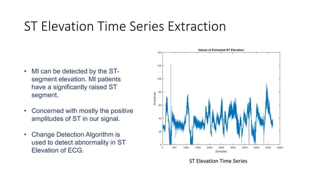 Ecg Signal Analysis For Myocardial Infarction Detection Ppt
