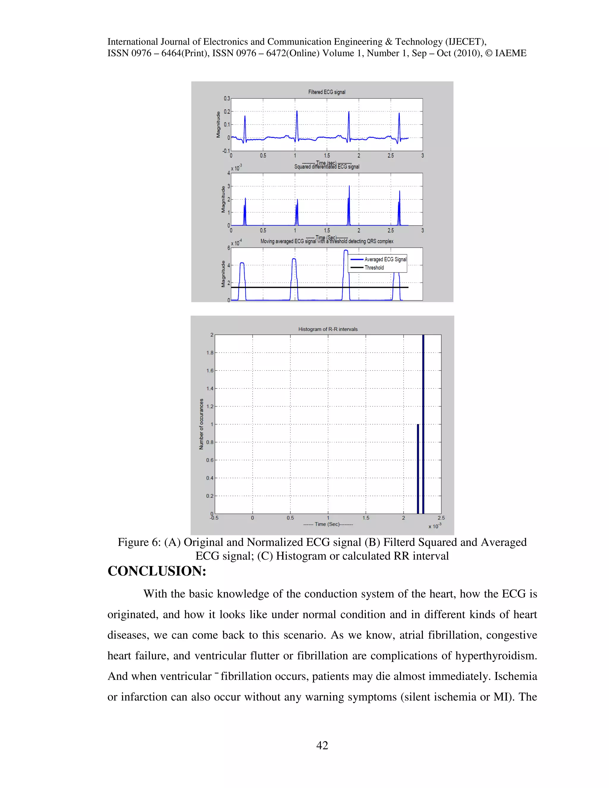 Ecg Signal Processing For Detection And Classification Of Cardiac Diseases Pdf Heart And