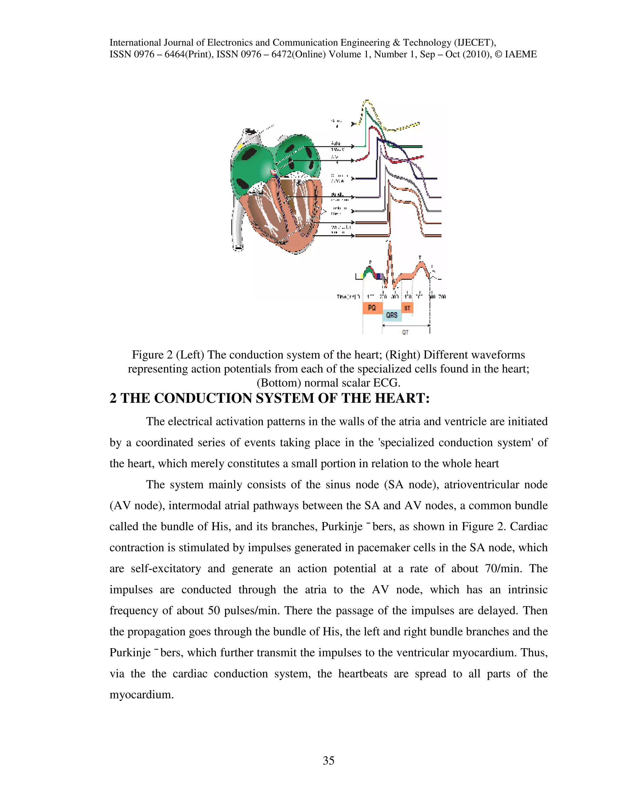 Ecg Signal Processing For Detection And Classification Of Cardiac