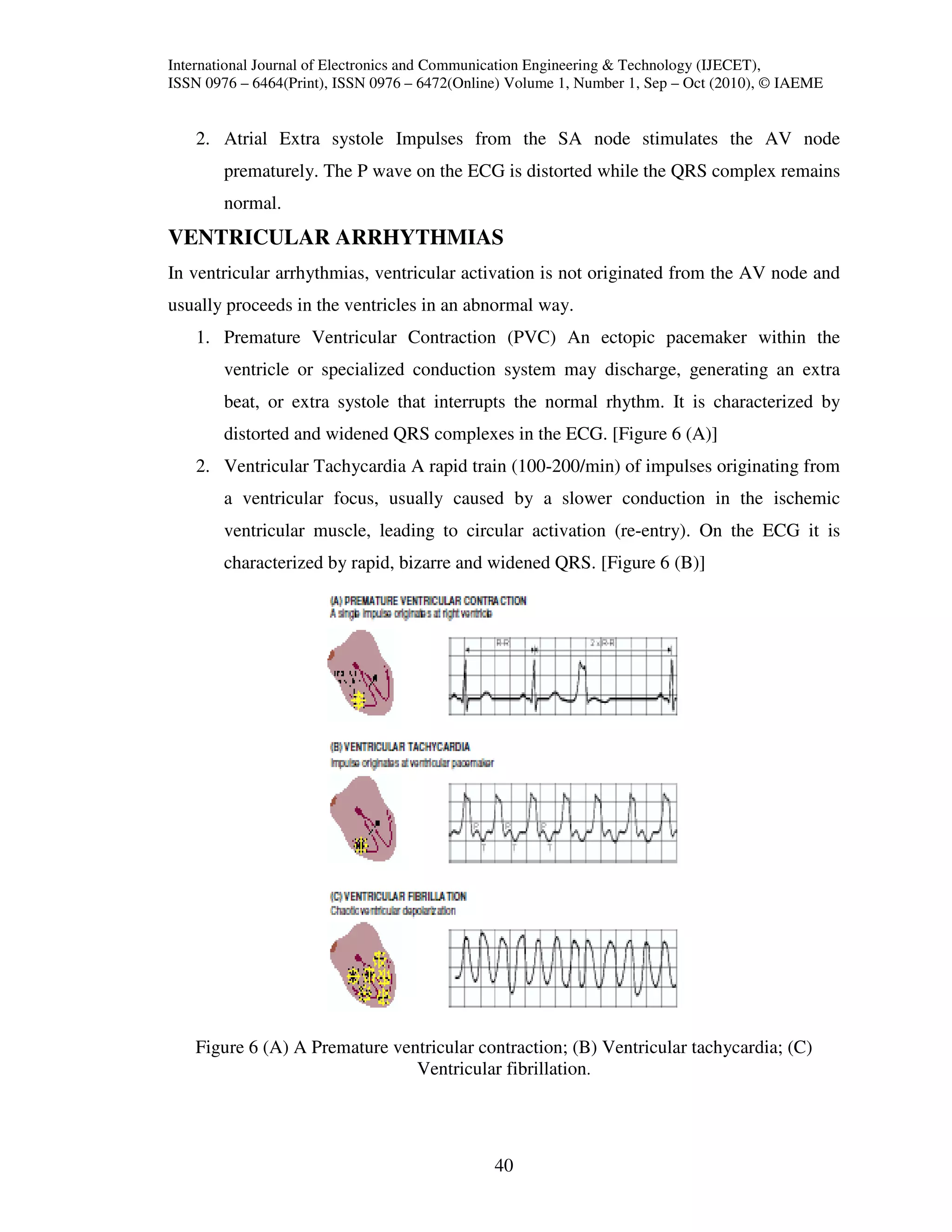 Ecg signal processing for detection and classification of cardiac ...