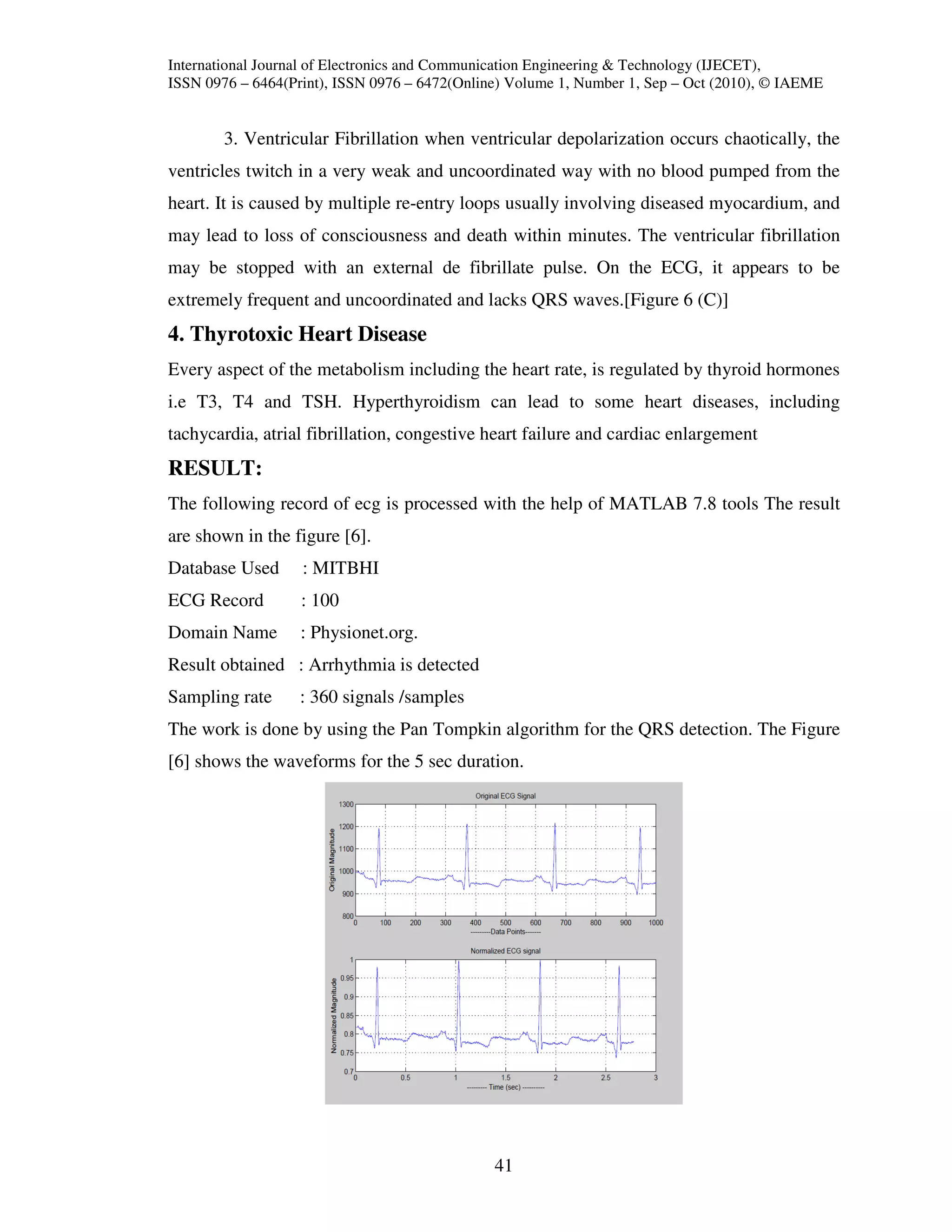 Ecg Signal Processing For Detection And Classification Of Cardiac
