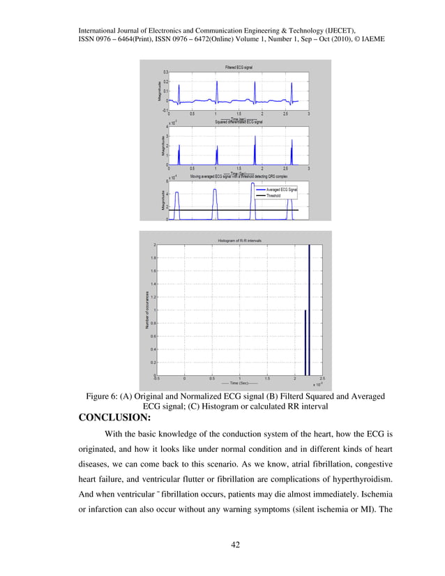 Ecg signal processing for detection and classification of cardiac ...