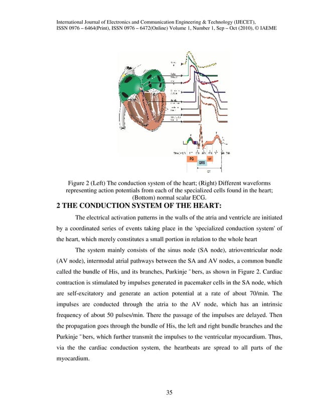 Ecg signal processing for detection and classification of cardiac ...