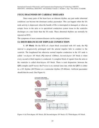 Ecg signal processing for detection and classification of cardiac ...