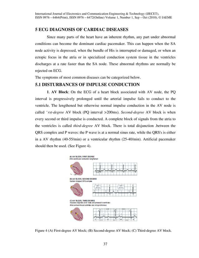 Ecg signal processing for detection and classification of cardiac ...