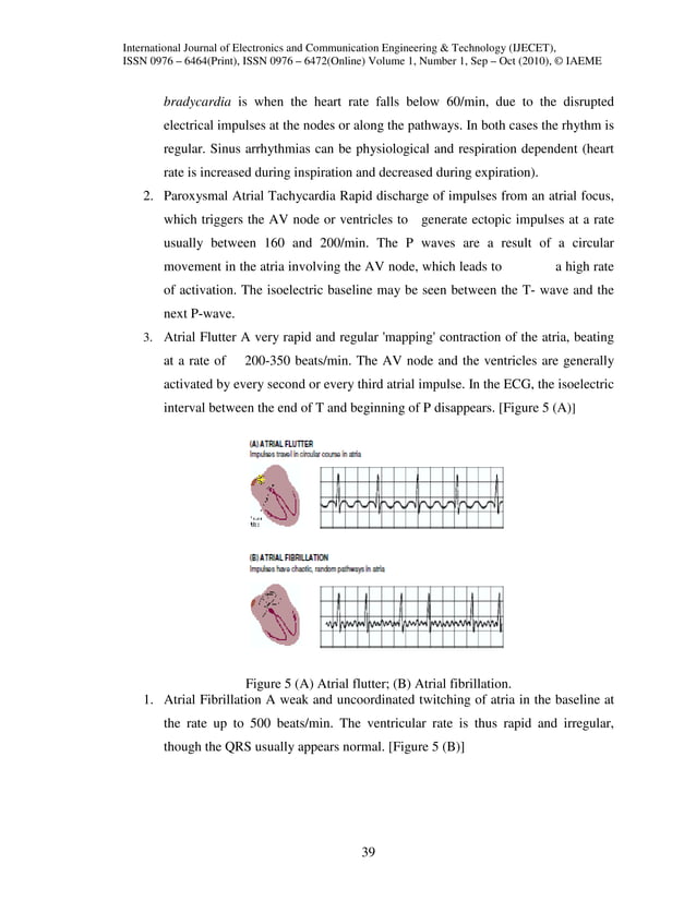 Ecg signal processing for detection and classification of cardiac ...