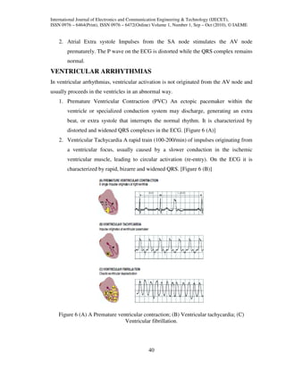 Ecg signal processing for detection and classification of cardiac ...