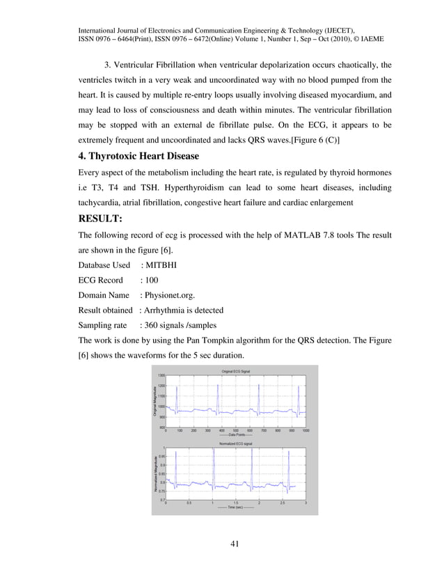 Ecg signal processing for detection and classification of cardiac ...