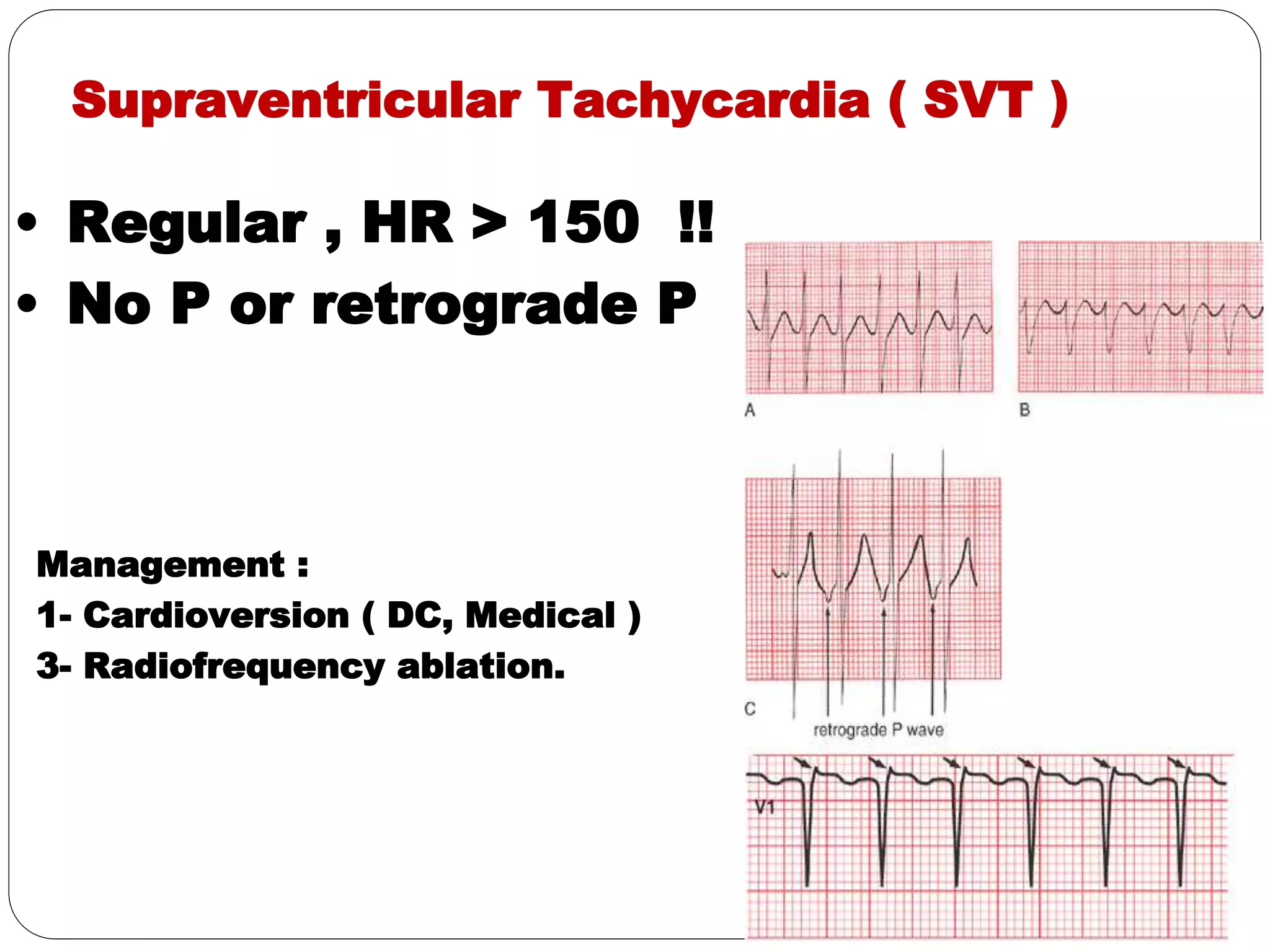 ECG Simple Approach.pptx