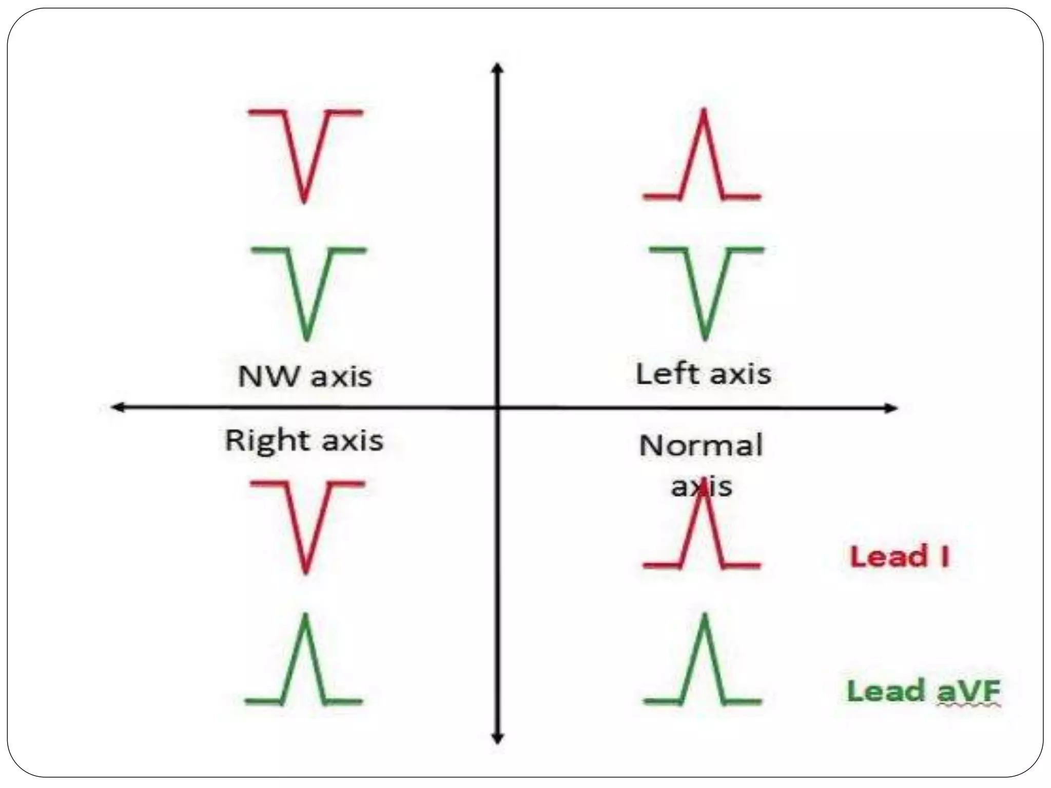 ECG Simple Approach.pptx