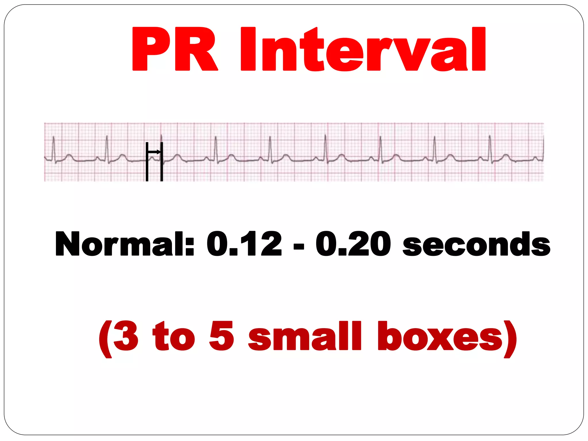 ECG Simple Approach.pptx