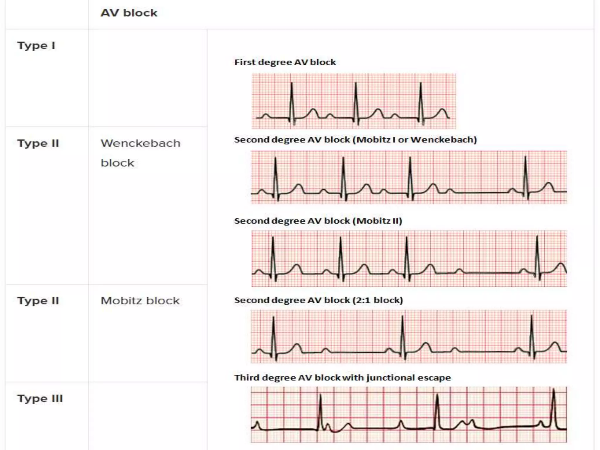 ECG Simple Approach.pptx