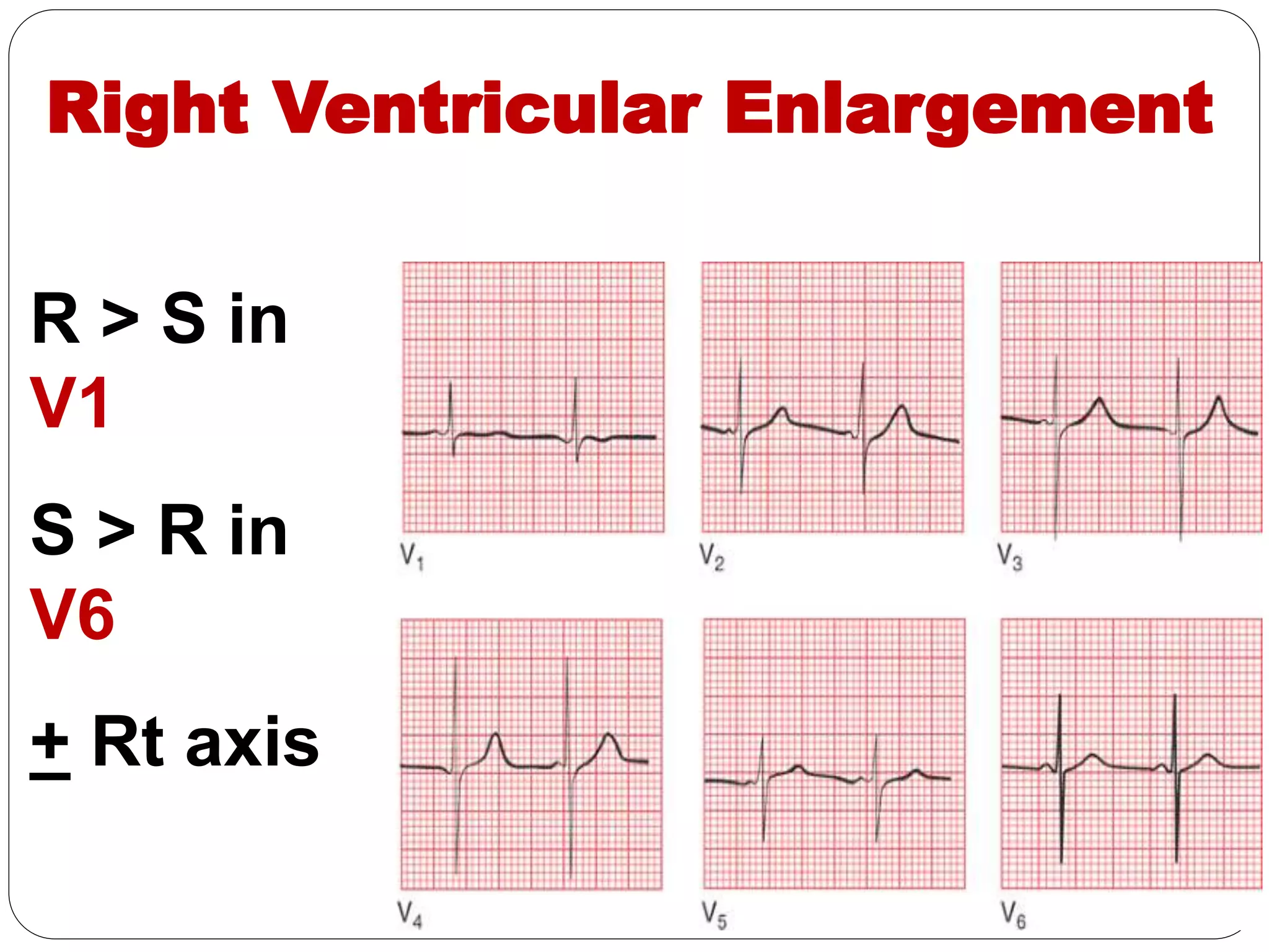 ECG Simple Approach.pptx