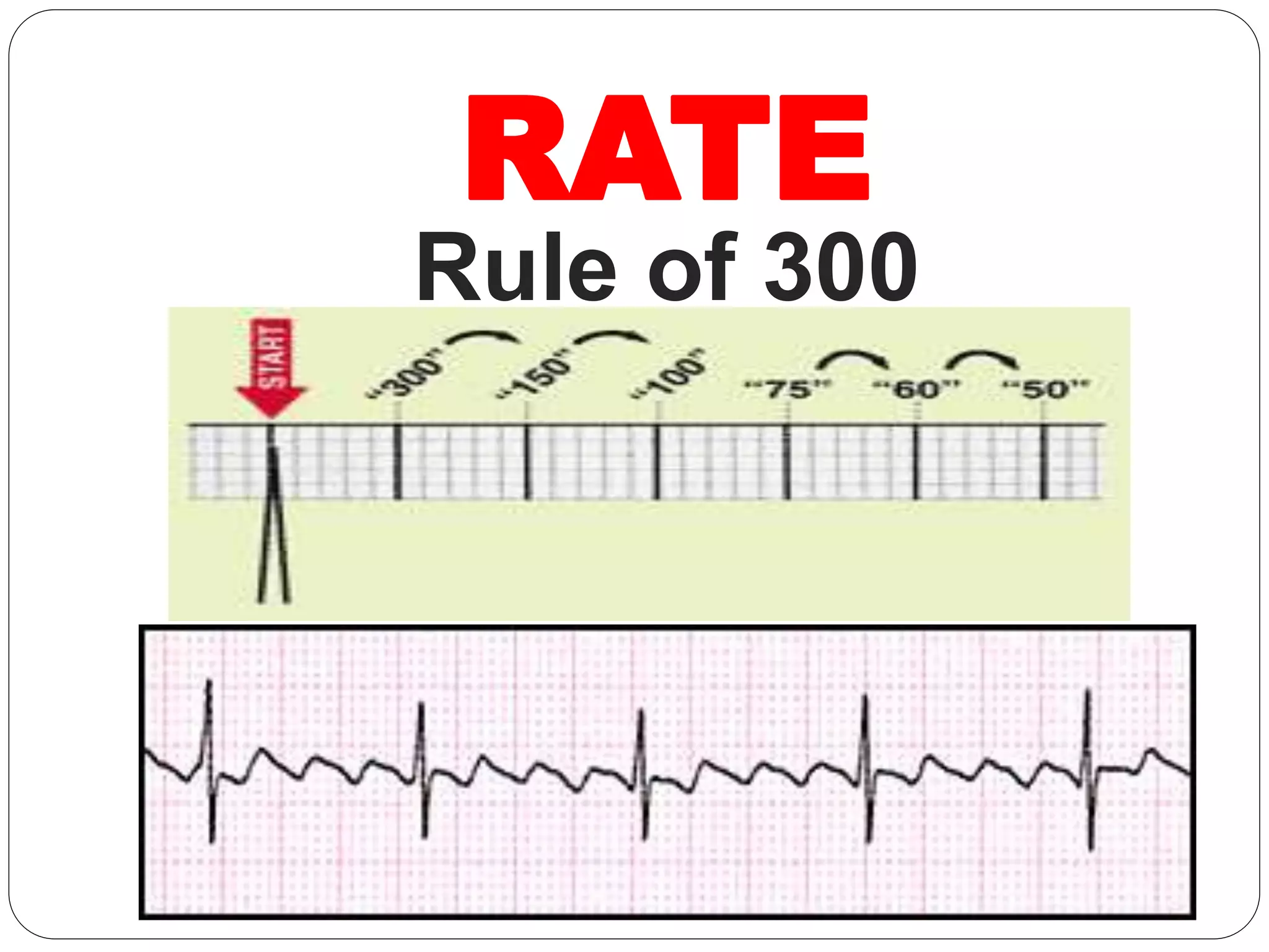 ECG Simple Approach.pptx