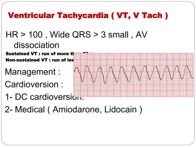 ECG Simple Approach.pptx